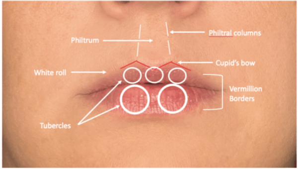 Navigating the Art and Science of Lip Fillers | Halley Medical Aesthetics