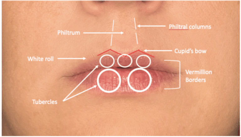 Navigating the Art and Science of Lip Fillers | Halley Medical Aesthetics