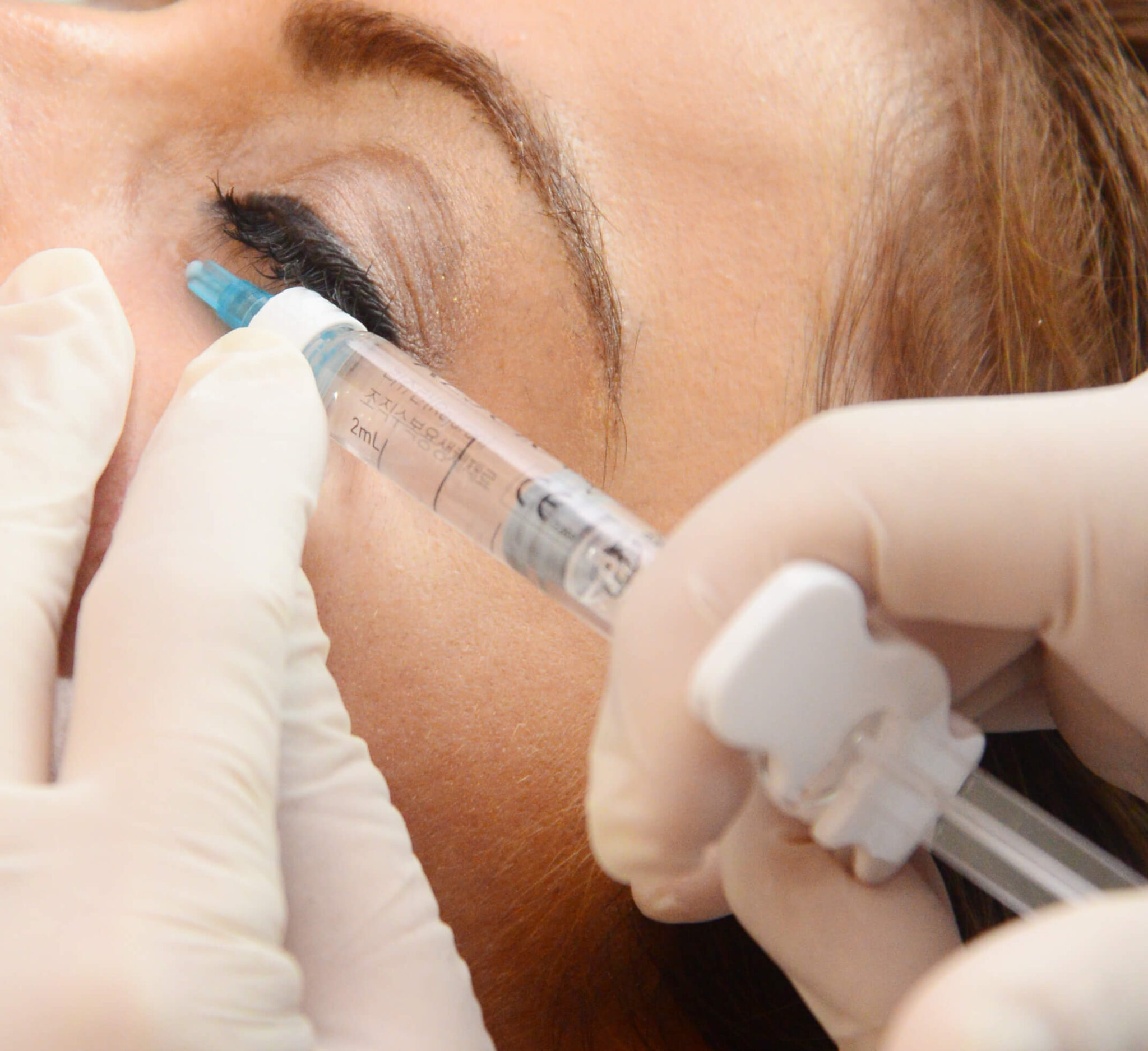 PN/PDRN Skin Booster for Eye Area Singapore | Halley Medical Aesthetics
